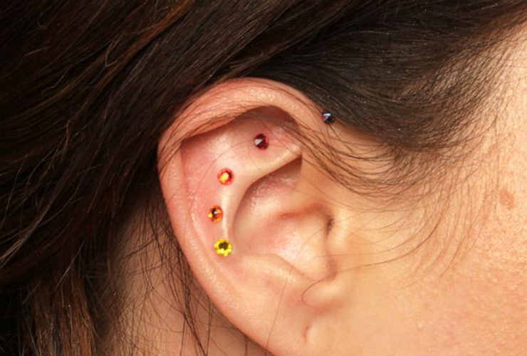 Ear Seeds Can An Ancient Medicine Practice Promote Mind Body Healing